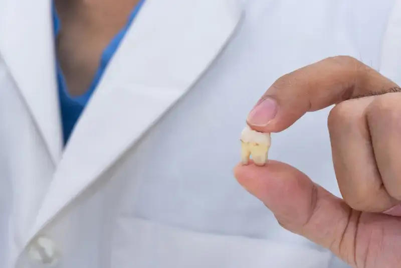 Tooth Extractions in Richmond, TX - Richmond Dental Care